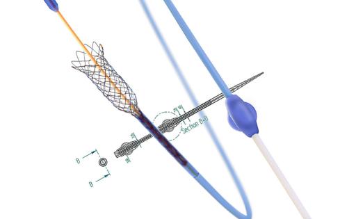 Minimally Invasive Delivery Systems for Catheters | Saint-Gobain